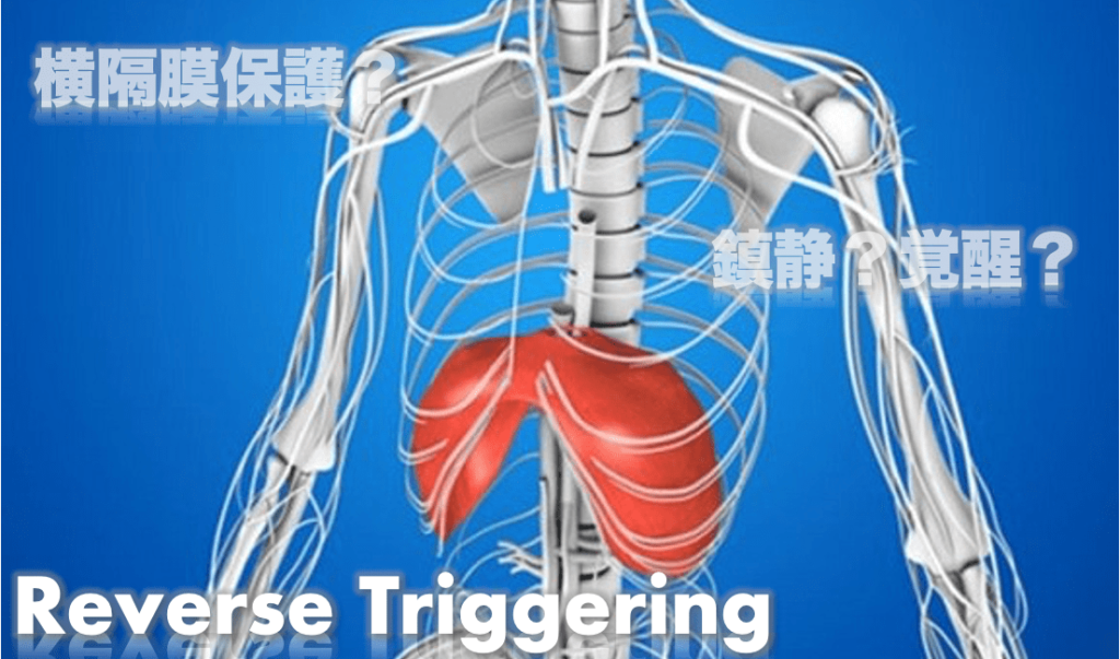 リバーストリガー（Reverse Triggering）を理解しよう | ICUと呼吸器外来のあいだ