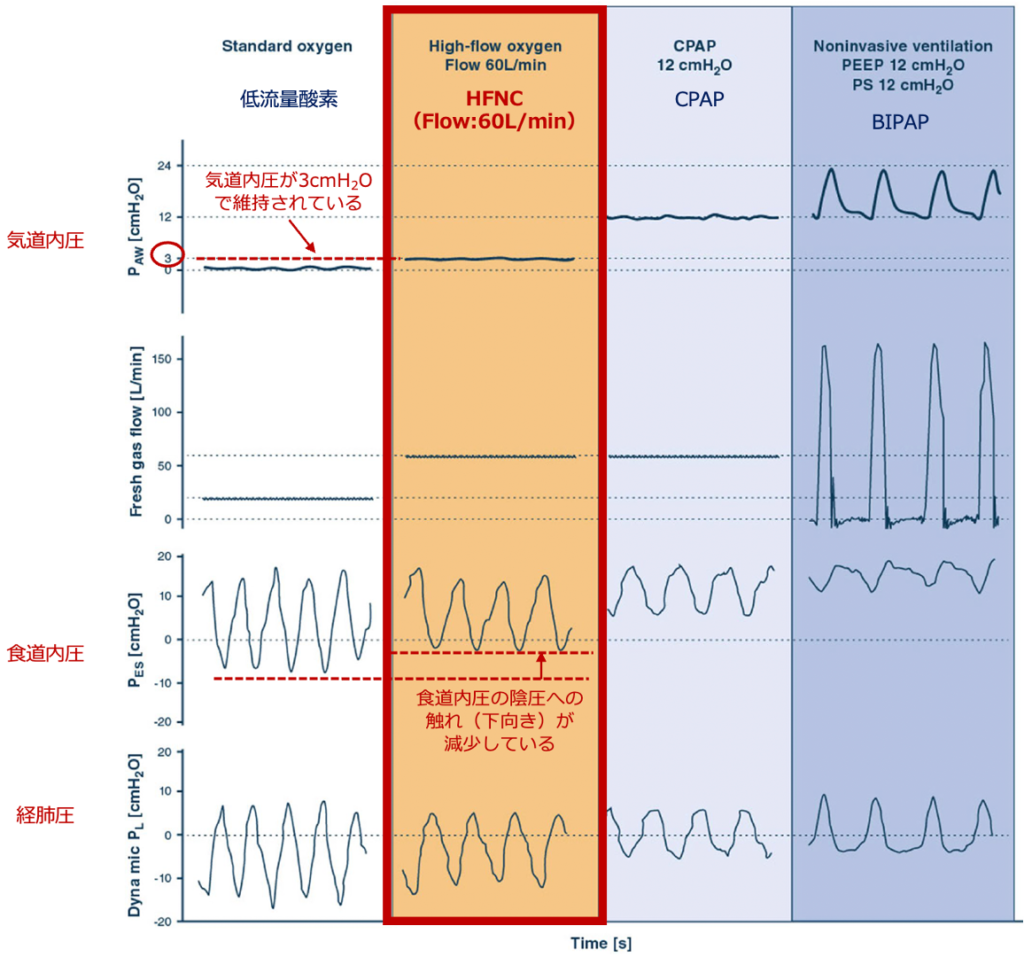 HFNCにPEEP効果はあるのか？ | ICUと呼吸器外来のあいだ