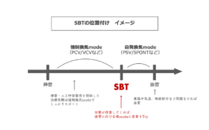 SBTをやってみよう！ | ICUと呼吸器外来のあいだ